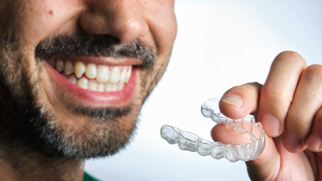 The Many Benefits of Clear Aligners | Invisible Braces Highgate Hill QLD